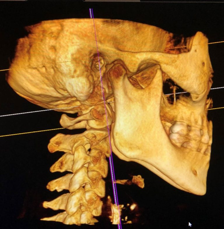 Dr. Alex Bello – Los Angeles Upper Cervical Chiropractor - Los Angeles ...